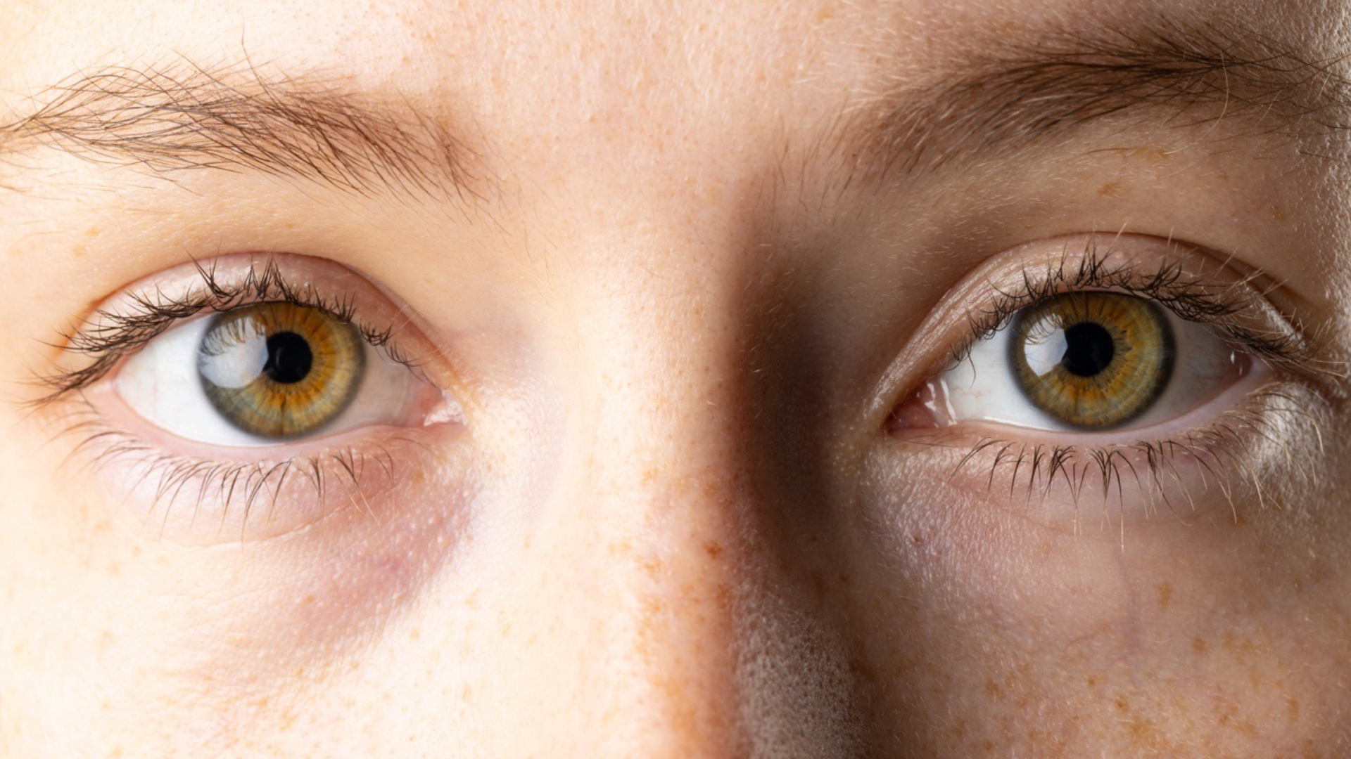 Can Eye Color Really Reveal Disease? | ArokaGO - Medical and Wellness Tourism Platform